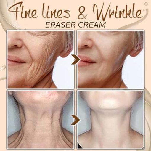 Snake Active Erase Cream Solution - Online Low Prices - Molooco Shop