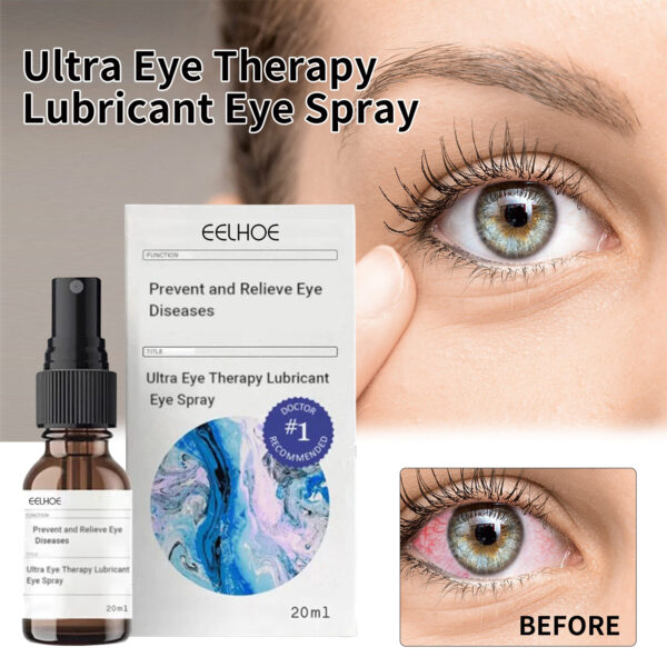 TLOPA™ Ultra Eye Therapy Drops - Buy Today Get 55% Discount - MOLOOCO