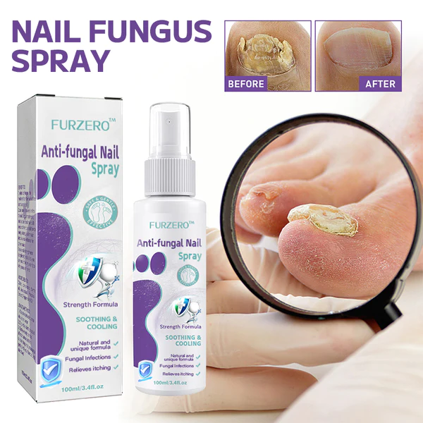 Furzero™Anti-fungal Nail Spray - Buy Today Get 55% Discount - MOLOOCO