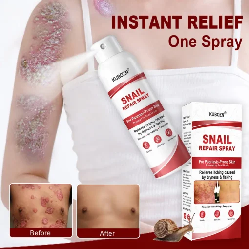 Snail Repair Spray for Itchy, Flaky Psoriasis Skin - Buy Today 80% OFF ...